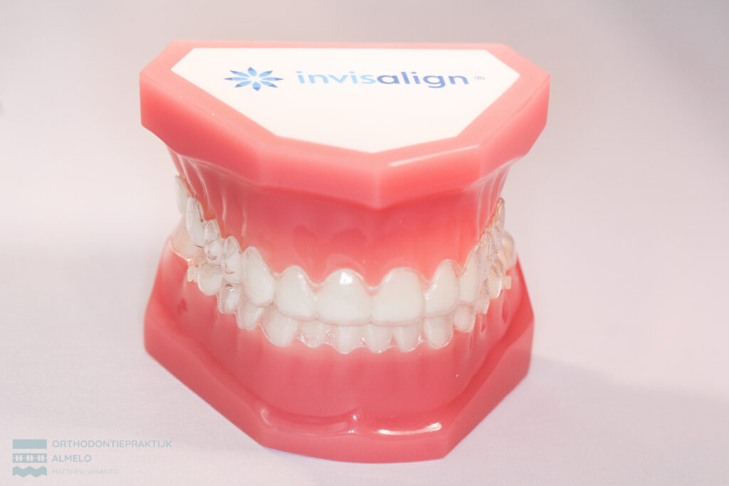 Onzichtbare beugel | Invisalign | Orthodontiepraktijk Almelo